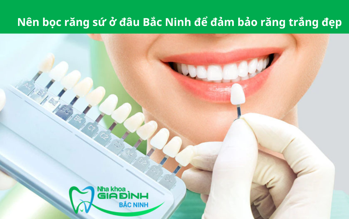 Nên bọc răng sứ ở đâu Bắc Ninh để đảm bảo răng trắng đẹp